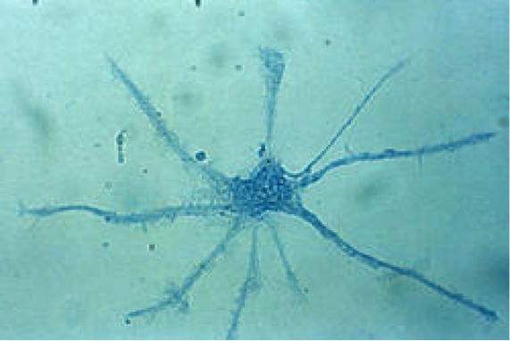 Les cellules dendritiques — Site des ressources d'ACCES pour enseigner ...